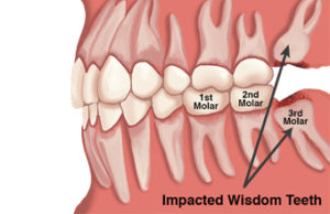 Dentist Guildford | Affordable Dental Treatments in Guildford