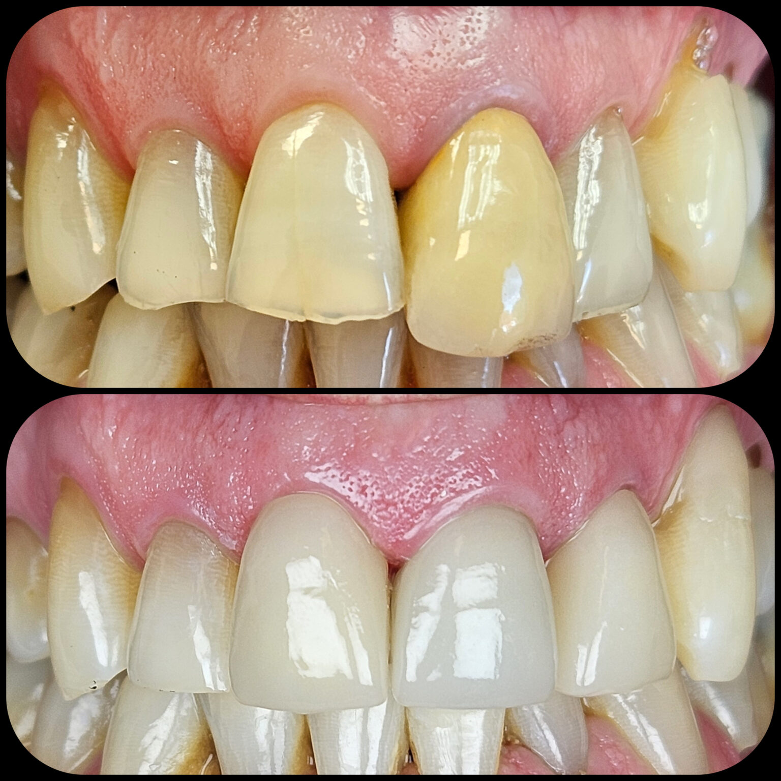 BeFunky-collage - Woodbridge Hill Dental Practice